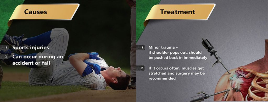 Common Shoulder Injuries – Causes and Treatment
