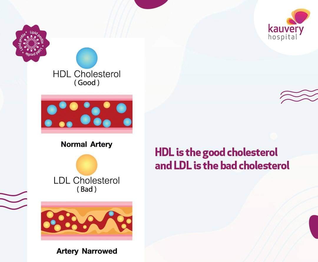 Great Tips to Lower Your Bad Cholesterol
