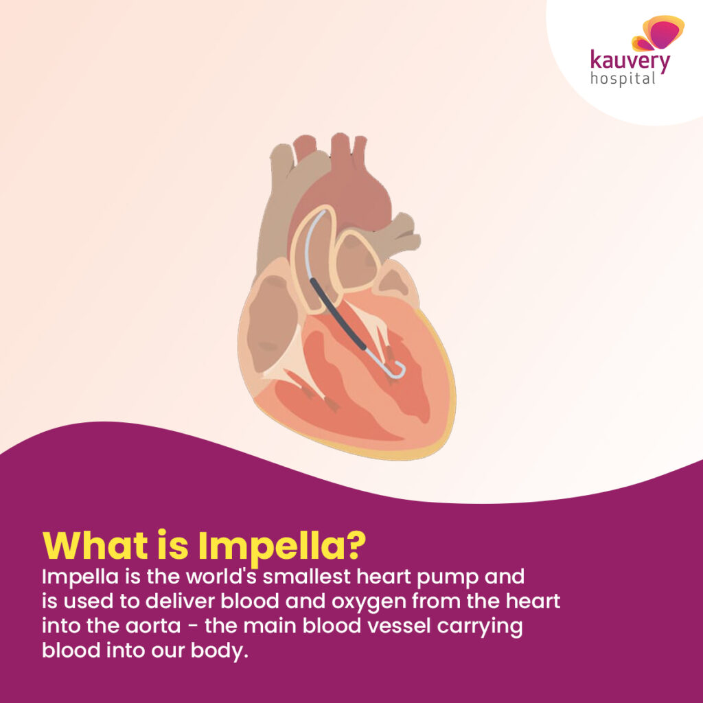 Impella Heart Pump – Necessity and Applications